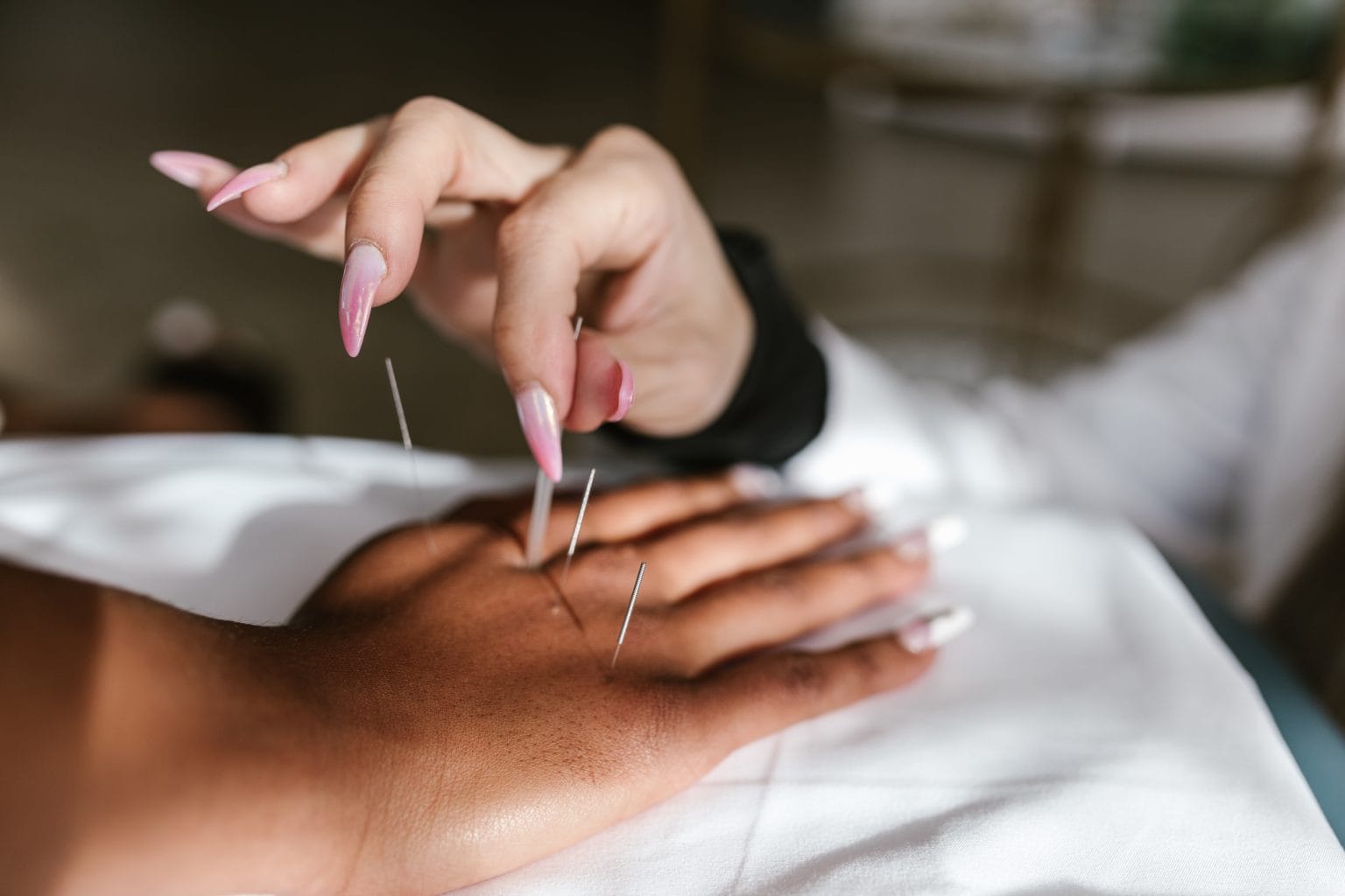 How Long Do You Leave Acupuncture Needles In Needle Pro How Long Do You Leave Acupuncture Needles In Needle Pro